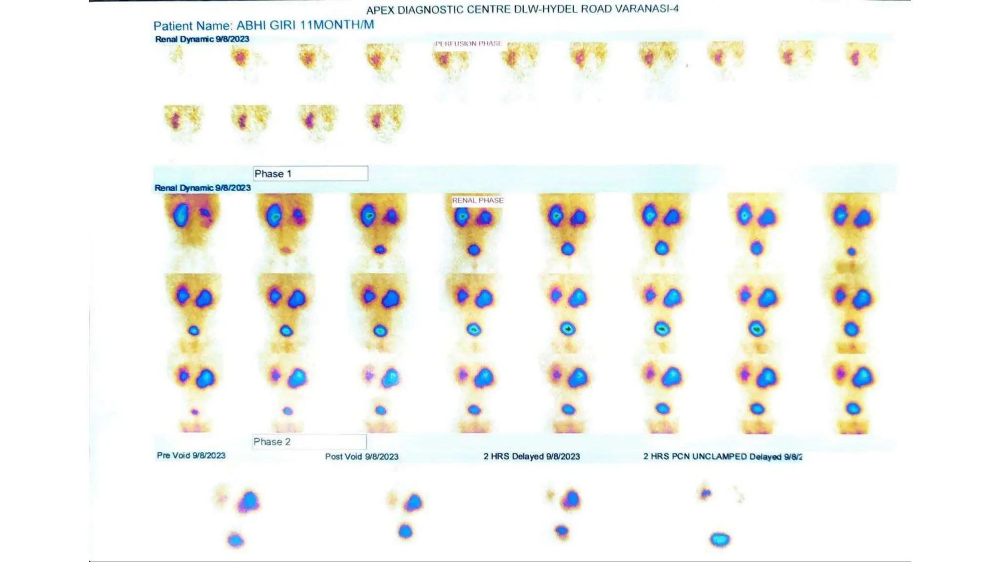 Renal Dynamic Scan - Isotope Scan - DTPA | PPTX