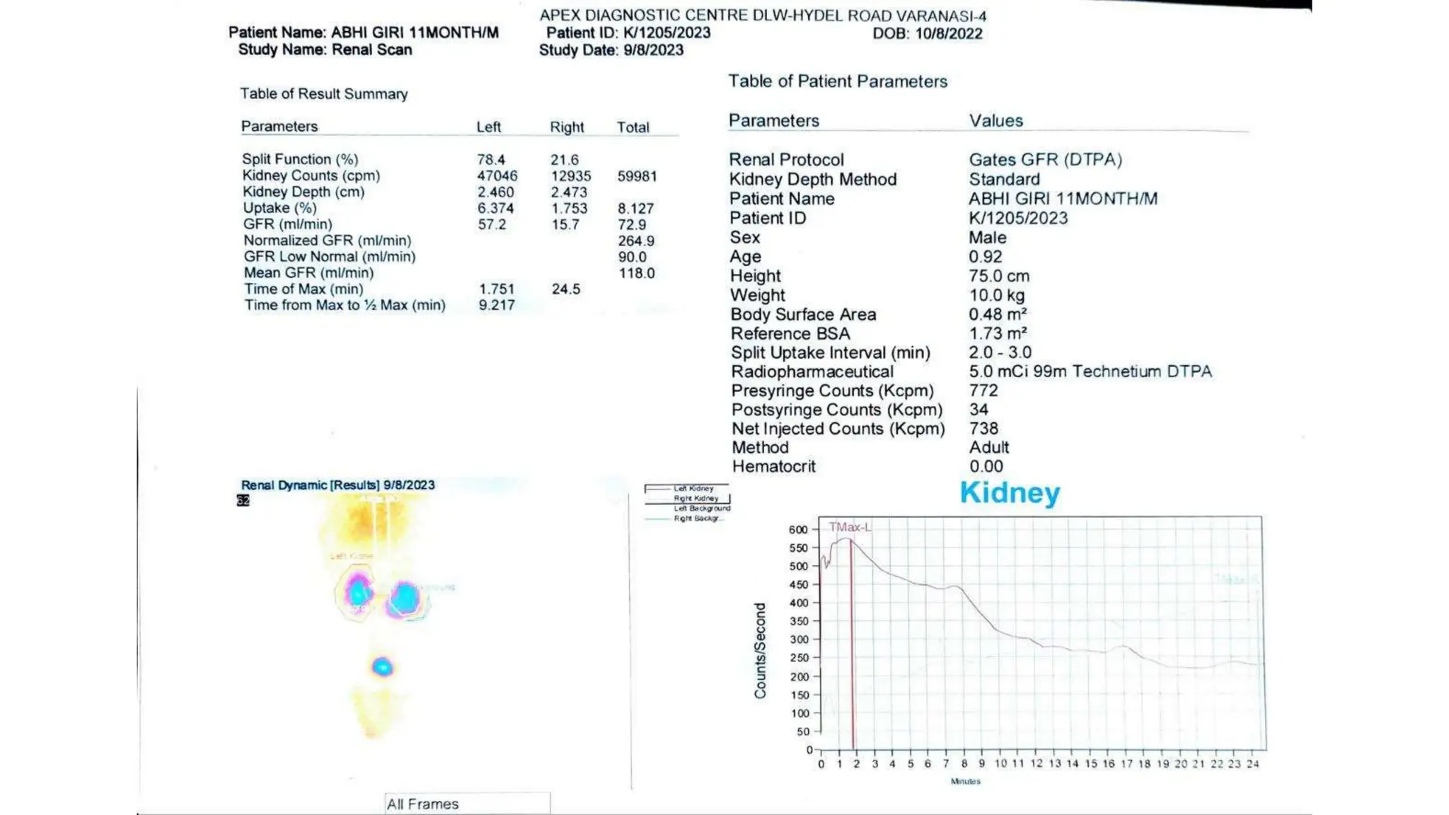 Renal Dynamic Scan - Isotope Scan - DTPA | PPTX