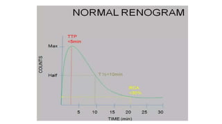 Renal Dynamic Scan - Isotope Scan - DTPA | PPTX
