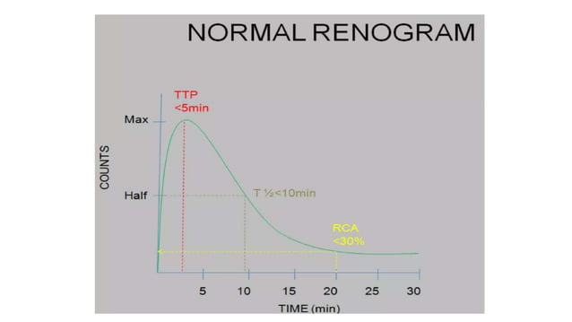 Renal Dynamic Scan - Isotope Scan - DTPA | PPTX