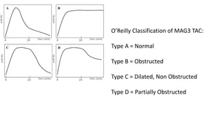 Renal Dynamic Scan - Isotope Scan - DTPA | PPTX