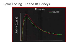 Renal Dynamic Scan - Isotope Scan - DTPA | PPTX