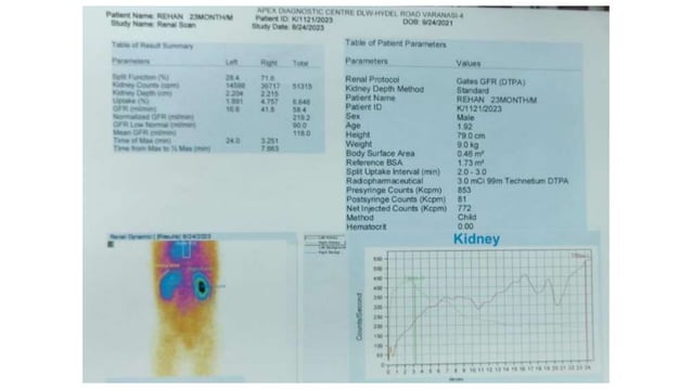 Renal Dynamic Scan - Isotope Scan - DTPA | PPTX