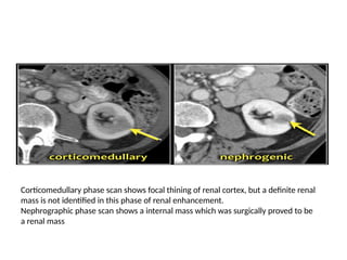Renal Mass Evaluation renal pathology .pptx
