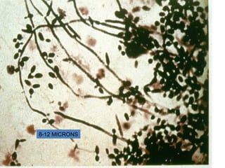renal module.pptx microbiology of renal module | PPTX