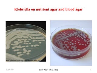 renal module.pptx microbiology of renal module | PPTX