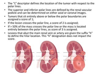 Renal Nephrometry.pptx