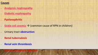 Renal Papillary Necrosis Ring Sign
