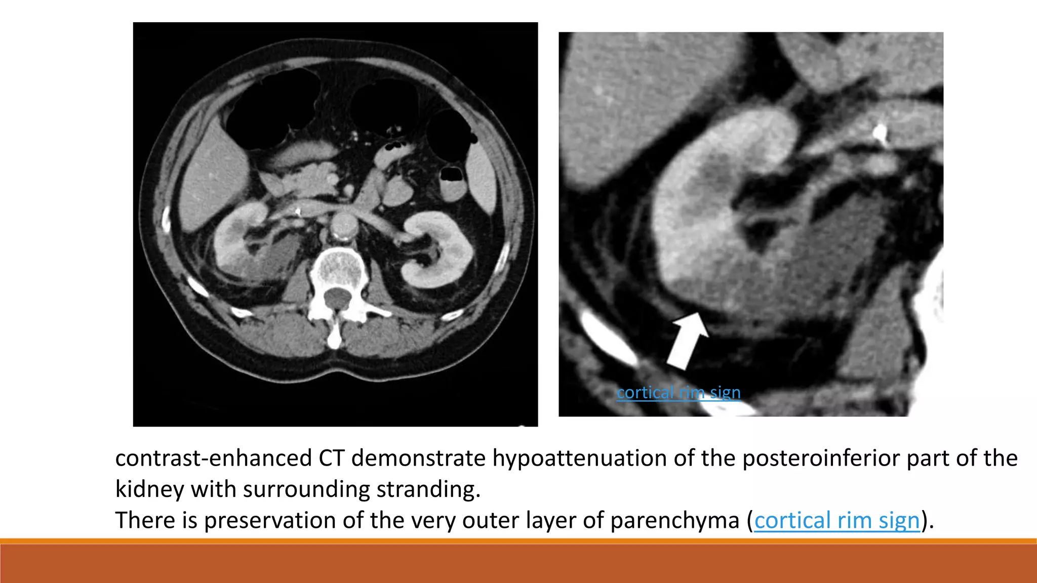 Renal Parenchymal Dieases.pptx