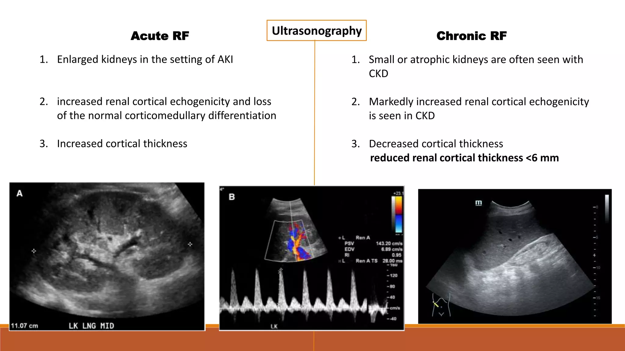 Renal Parenchymal Dieases.pptx