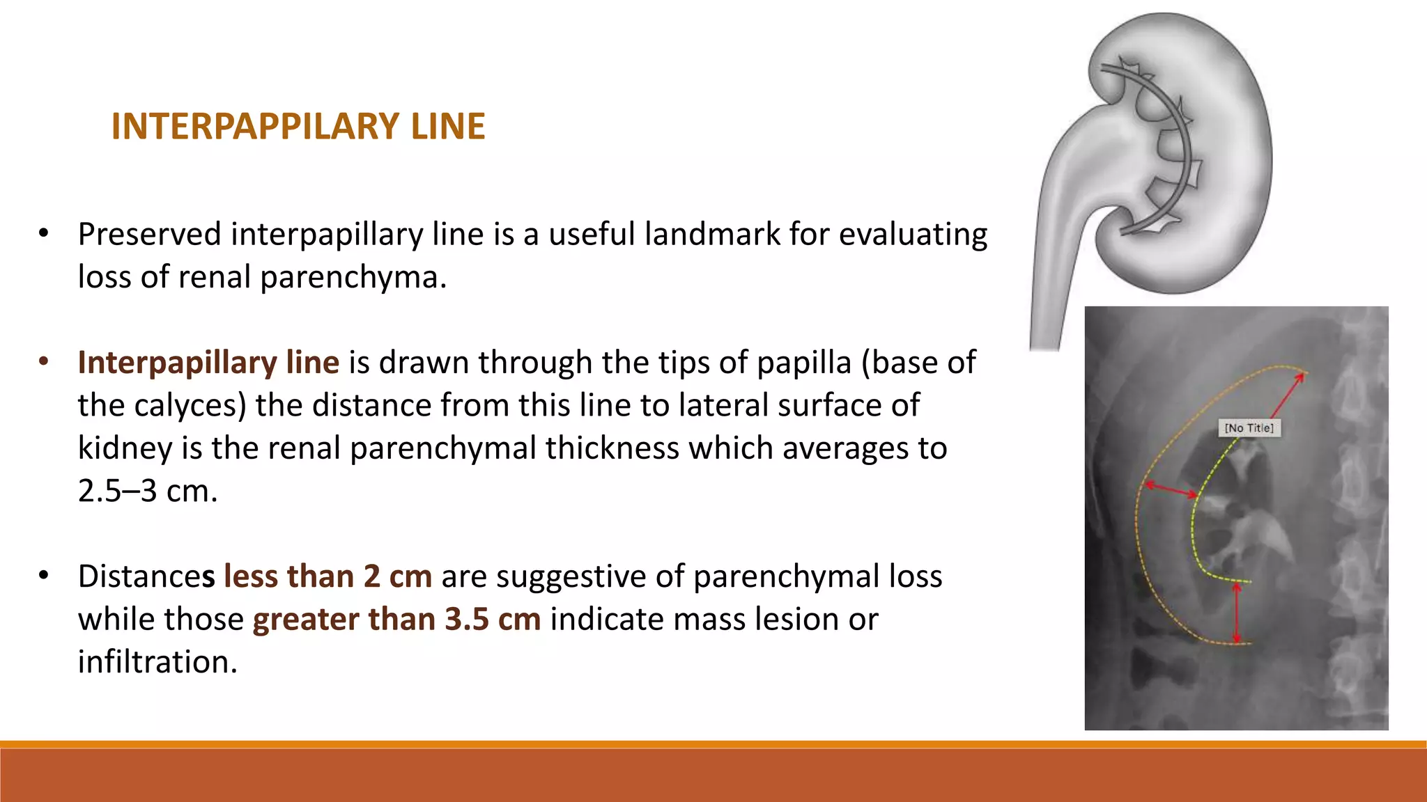 Renal Parenchymal Dieases.pptx