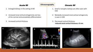 Renal Parenchymal Dieases.pptx