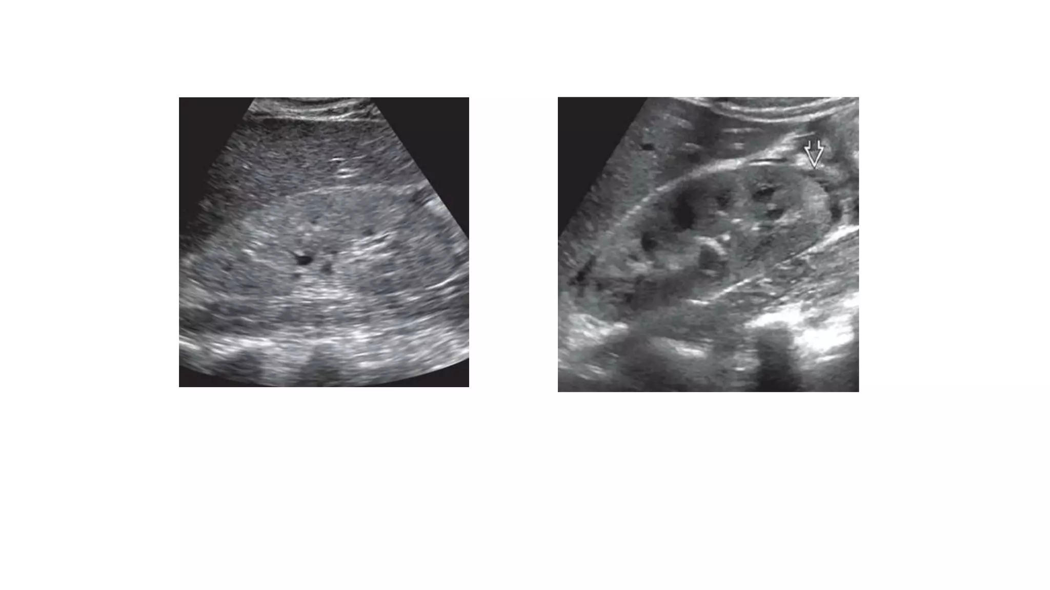 RENAL PARENCHYMAL DISEASE IMAGING.pptx