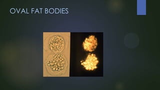 Renal pathology | PPTX