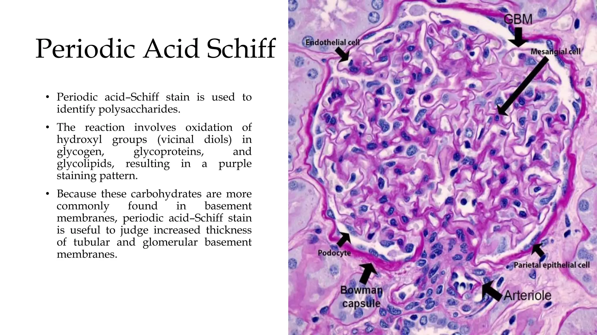 Renal pathology | PPTX