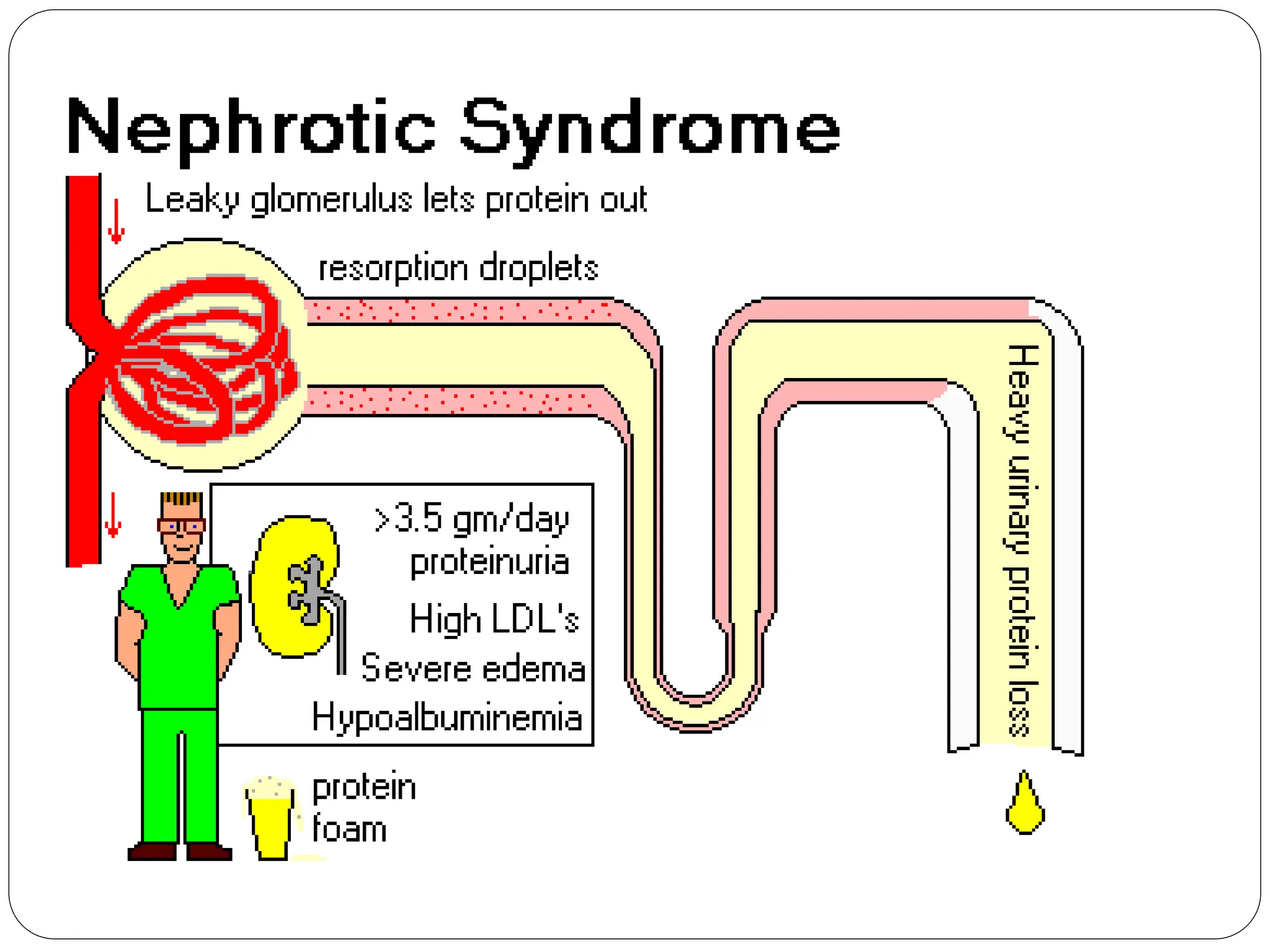 Renal_Pathology in the human pathology of the kidney | PPT
