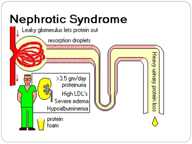 Renal_Pathology in the human pathology of the kidney | PPT