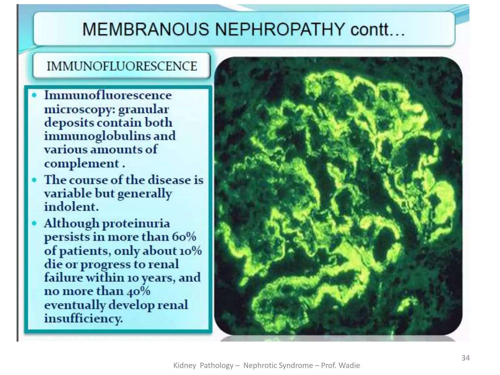 Renal pathology the nephrotic syndrome- prof wadie | PPTX
