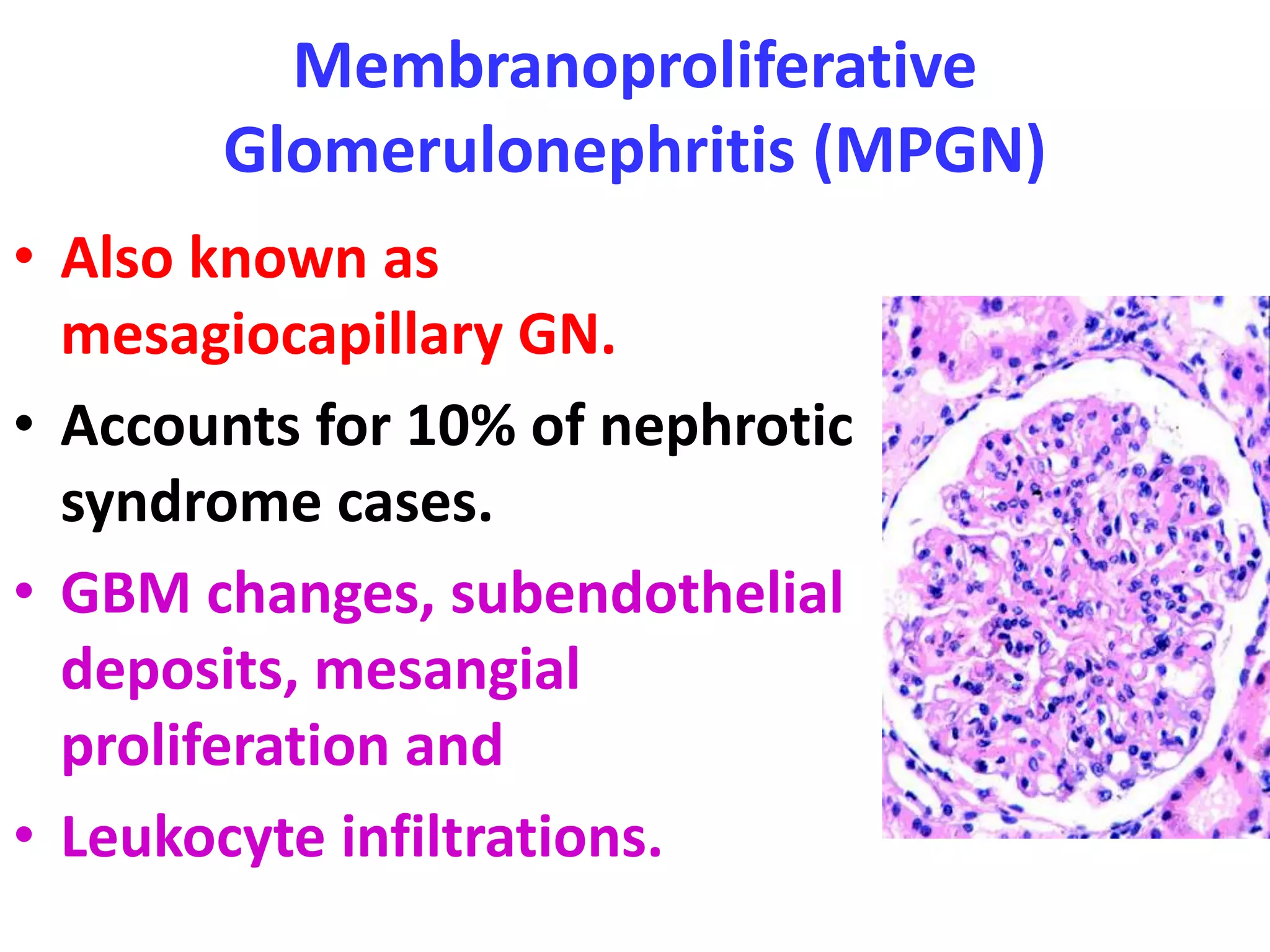 Renal pathology the nephrotic syndrome- prof wadie | PPTX