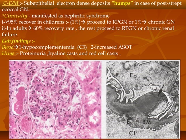 Renal pathology (dr magdy ismail) copy | PPT
