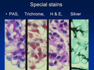 Renal pathology i | PPT