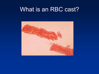 Renal pathology i | PPT