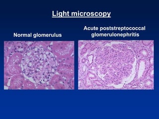 Renal pathology i | PPT