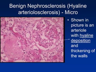 Renal pathology iii | PPT