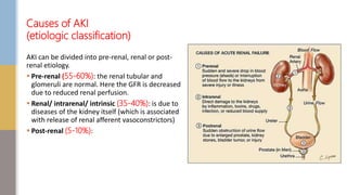 Renal pathology. Lecture 1 acute kidney injury, sufia husain 2020 | PPTX