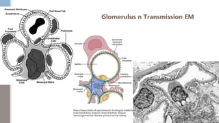 Renal pathology. Lecture 1 acute kidney injury, sufia husain 2020 | PPTX