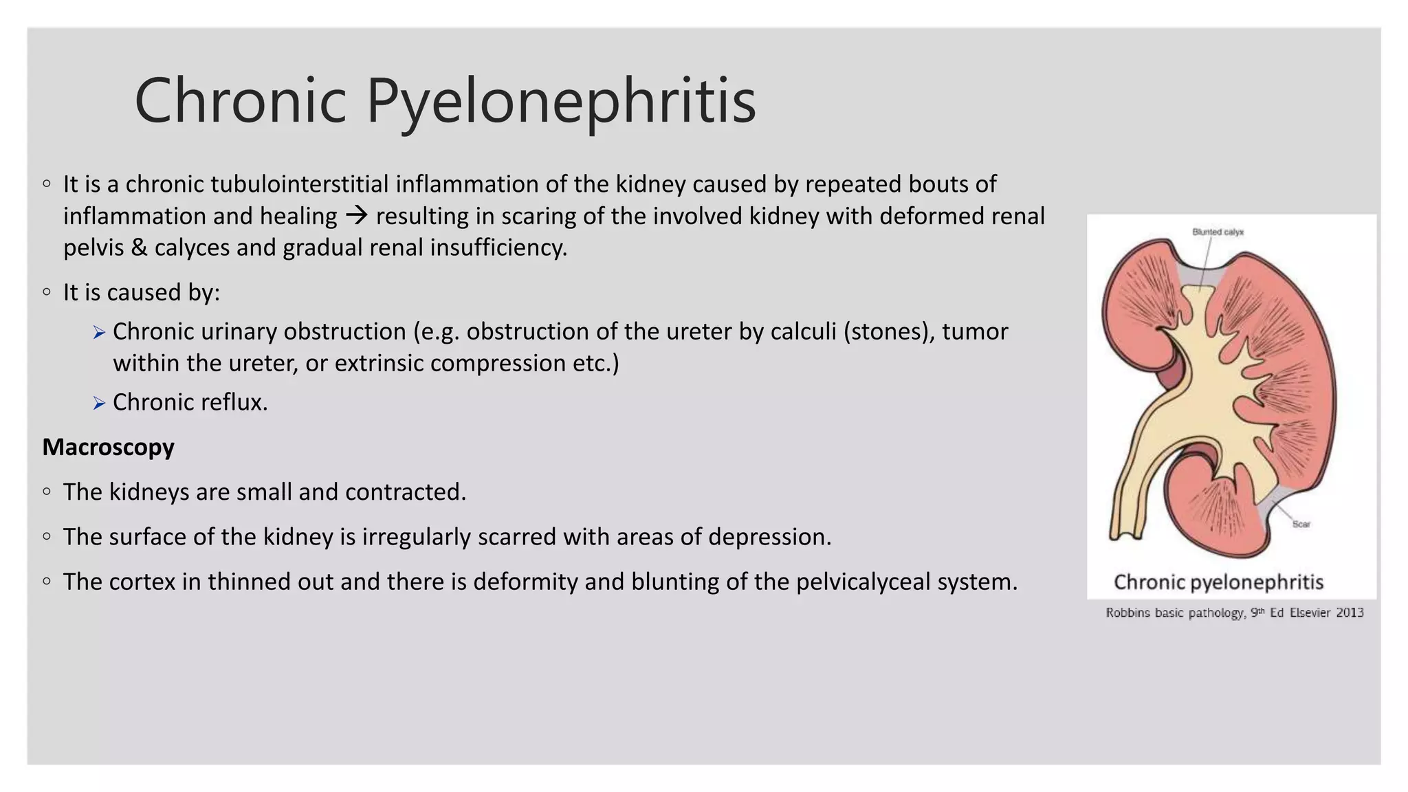 Renal pathology lecture 2&3. Infection of upper and lower urinary tract ...
