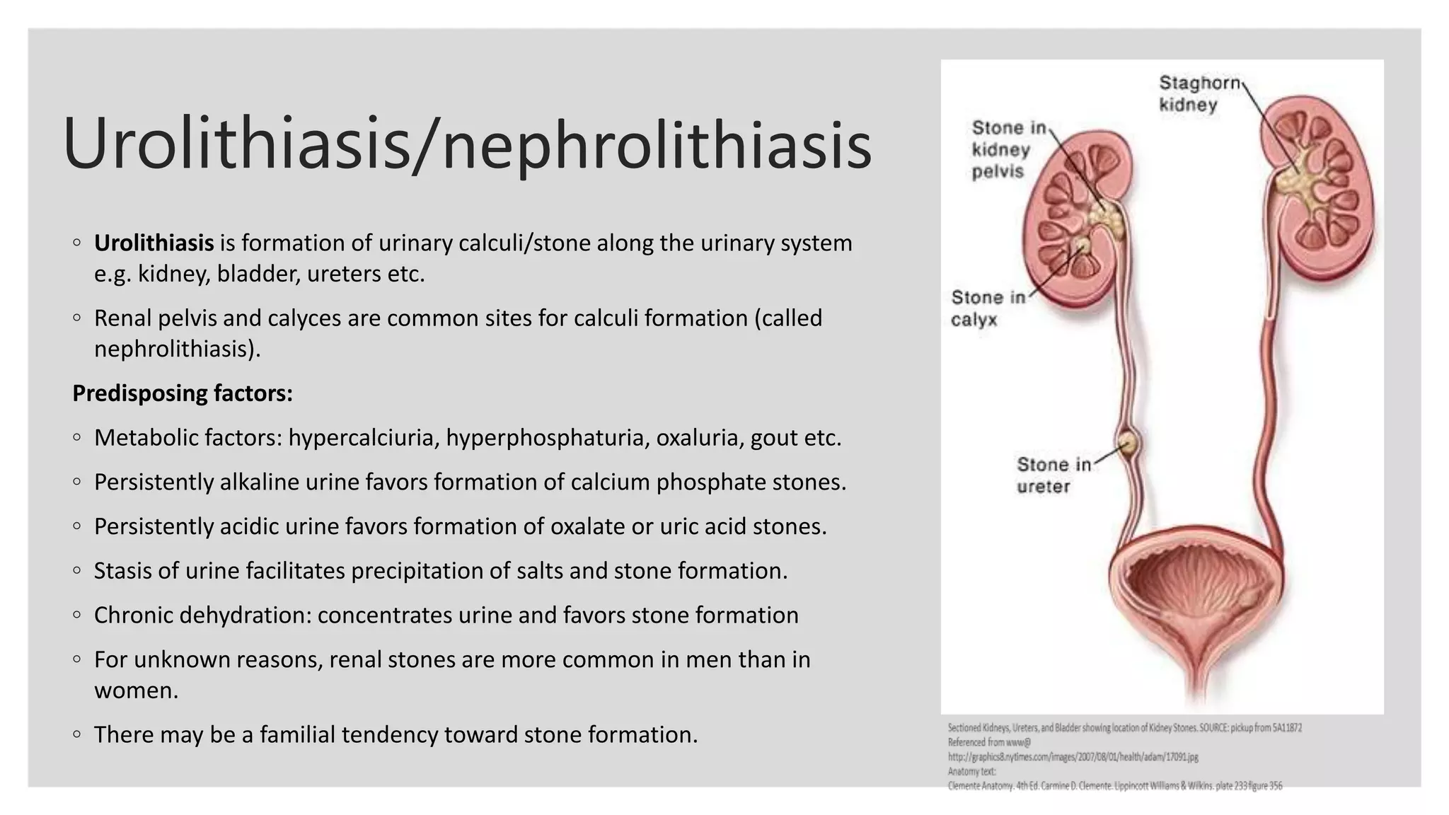 Renal pathology lecture 2&3. Infection of upper and lower urinary tract sufia husain 2020 | PPT