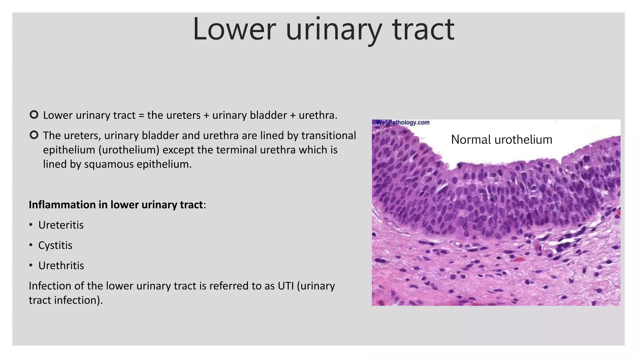 Renal pathology lecture 2&3. Infection of upper and lower urinary tract ...