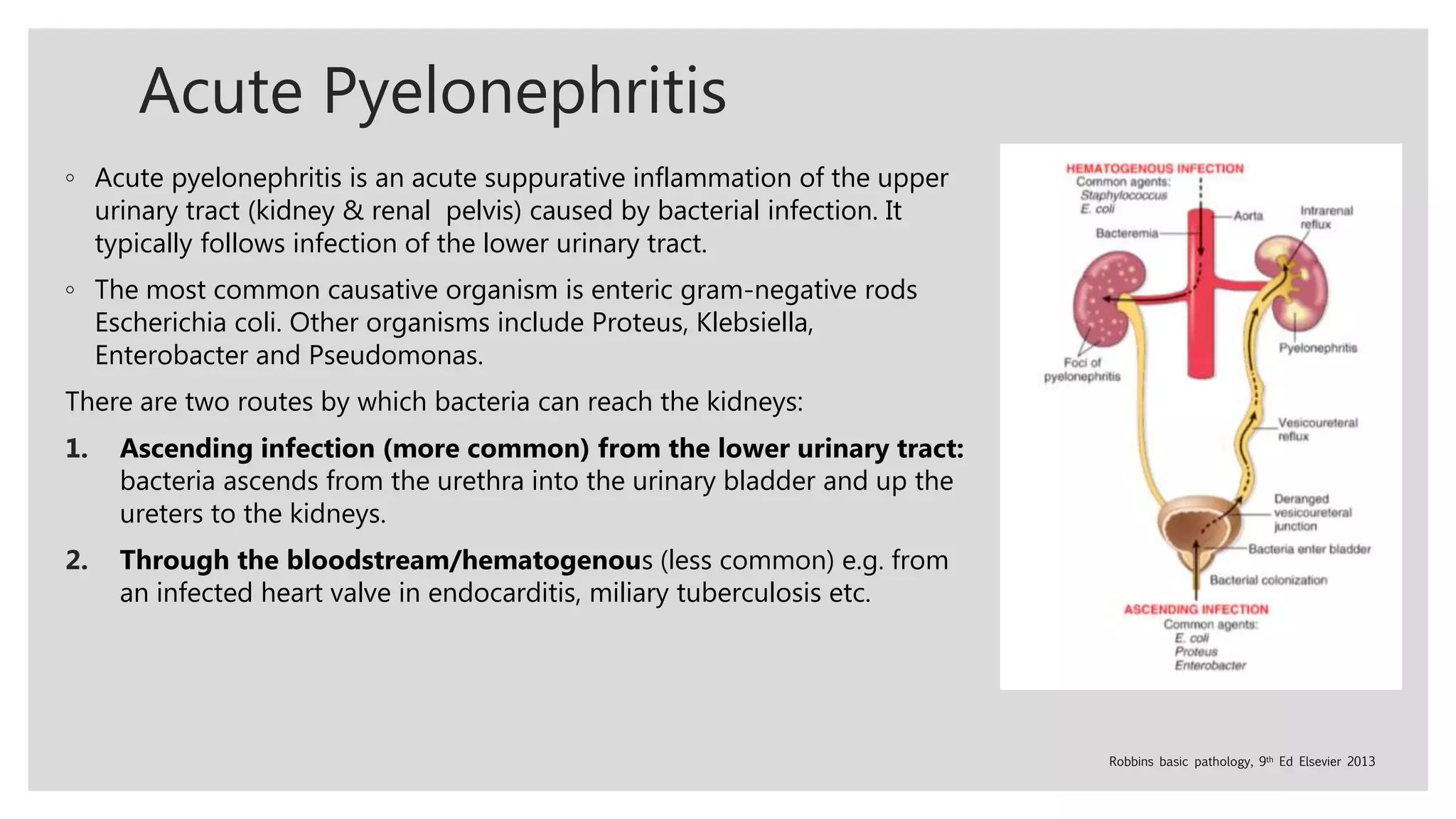 Renal pathology lecture 2&3. Infection of upper and lower urinary tract ...