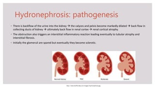 Renal pathology lecture 2&3. Infection of upper and lower urinary tract ...