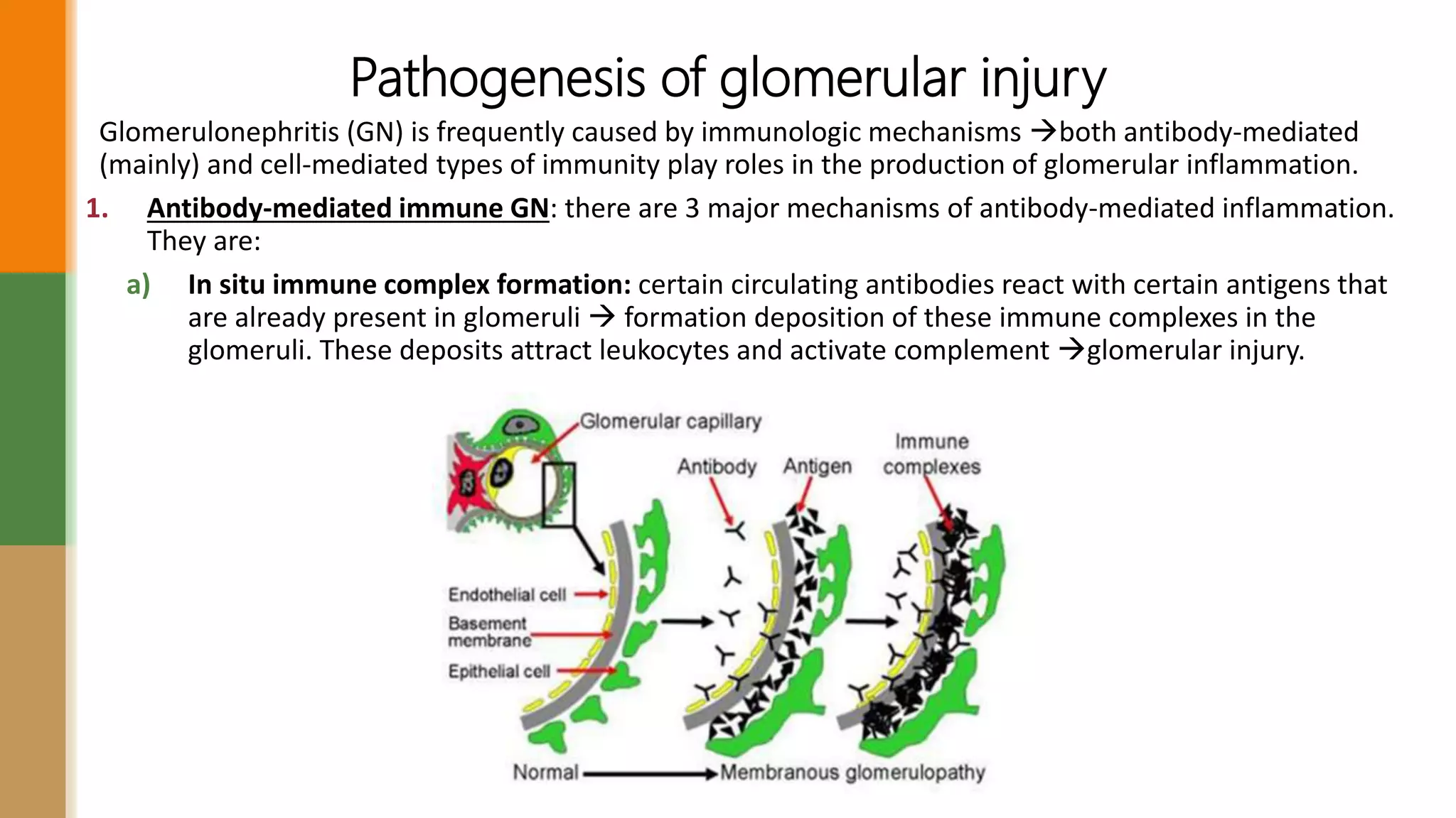 Renal pathology lecture5 Nephrotic & Nephritic syndrome. Sufia Husain ...