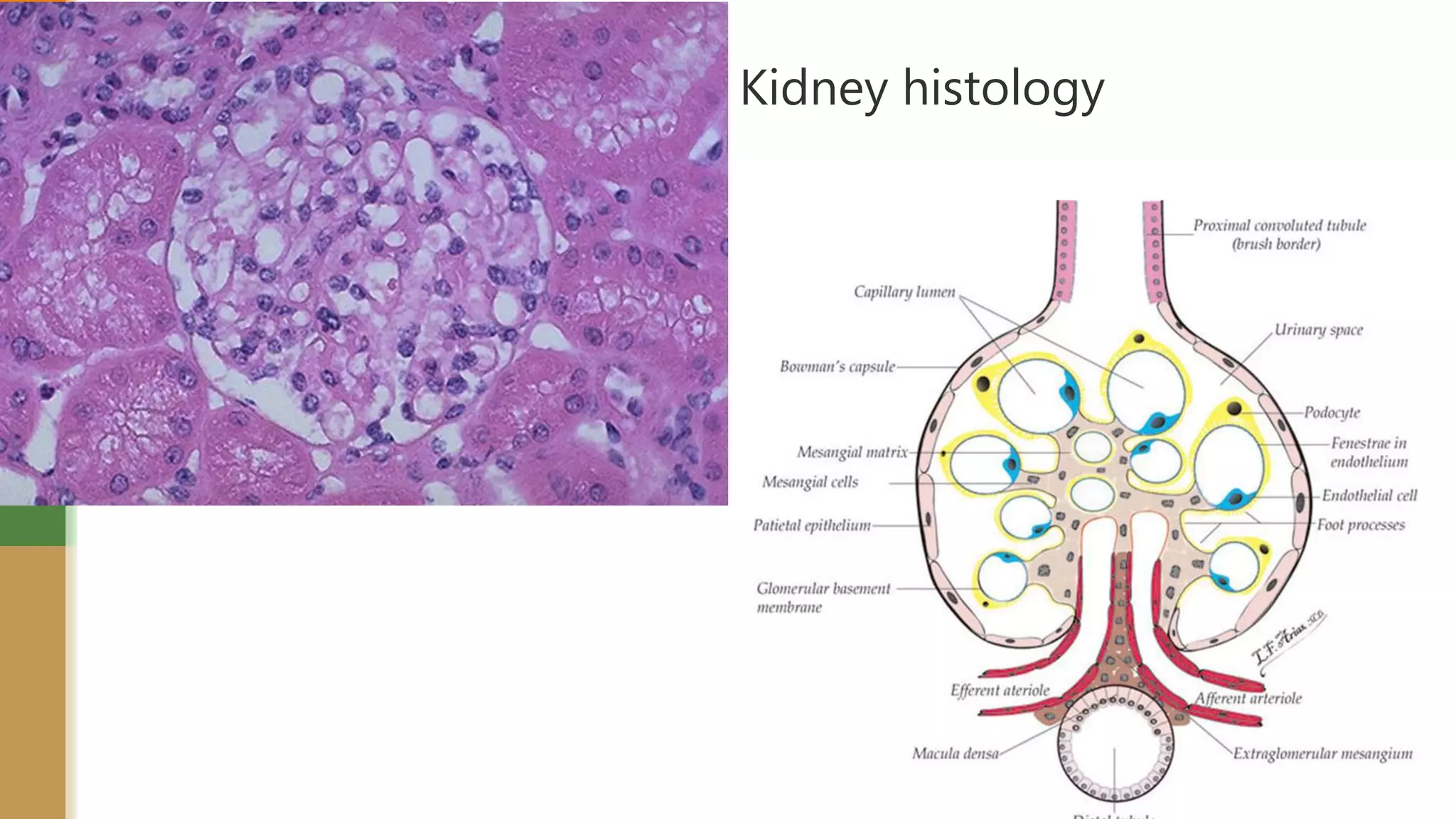 Renal pathology lecture5 Nephrotic & Nephritic syndrome. Sufia Husain ...