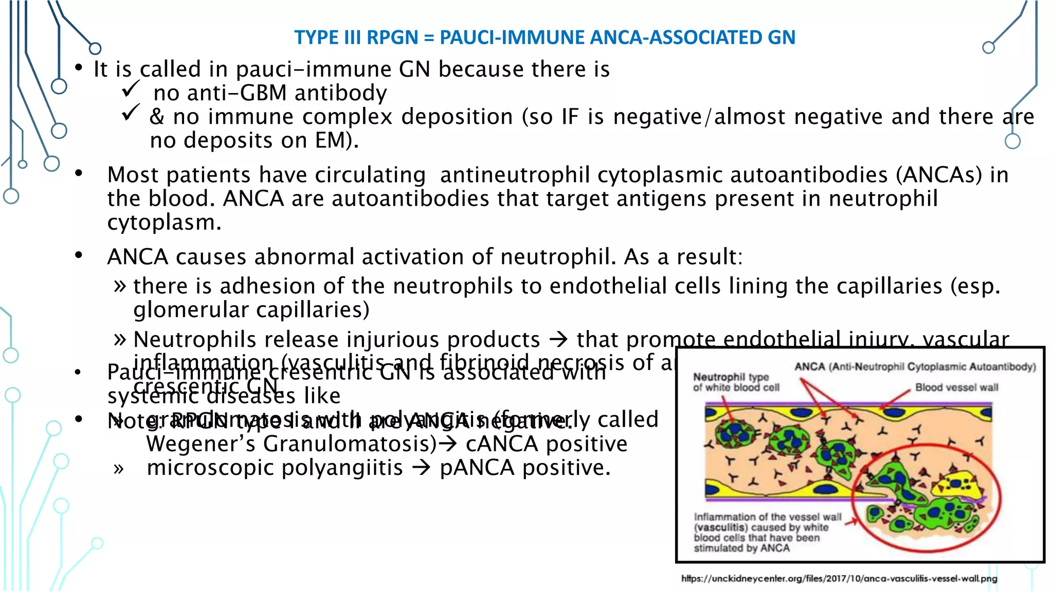 Renal pathology lecture 6 Rapid Progressive Glomerulonephritis ...