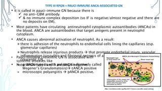 Renal pathology lecture 6 Rapid Progressive Glomerulonephritis ...