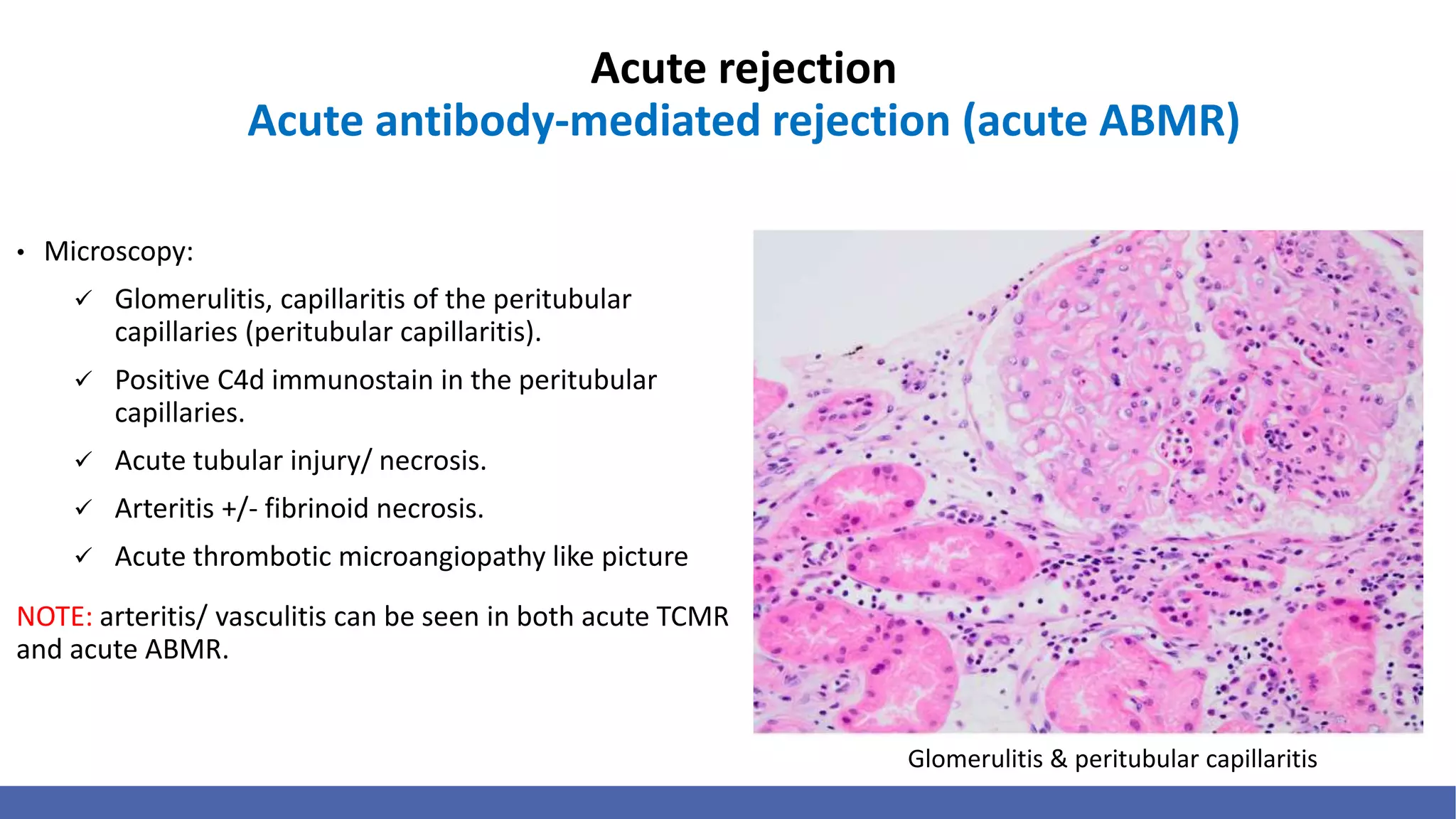Renal pathology. Lecture 7 Introduction to Allograft Kidney Pathology ...