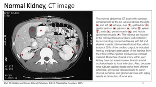 Renal Pathology Lectures_Ppt Series (4 in 1) | PDF