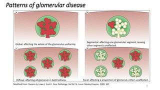 Renal Pathology Lectures_Ppt Series (4 in 1) | PDF