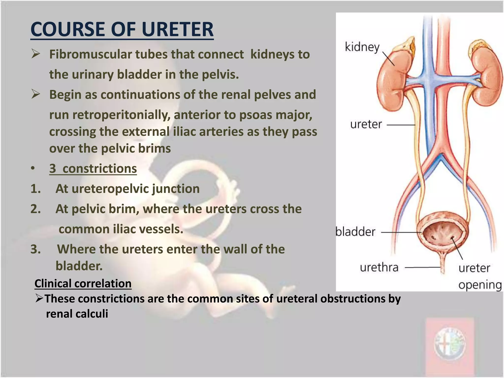 Developmental anomalies of Renal system | PPTX