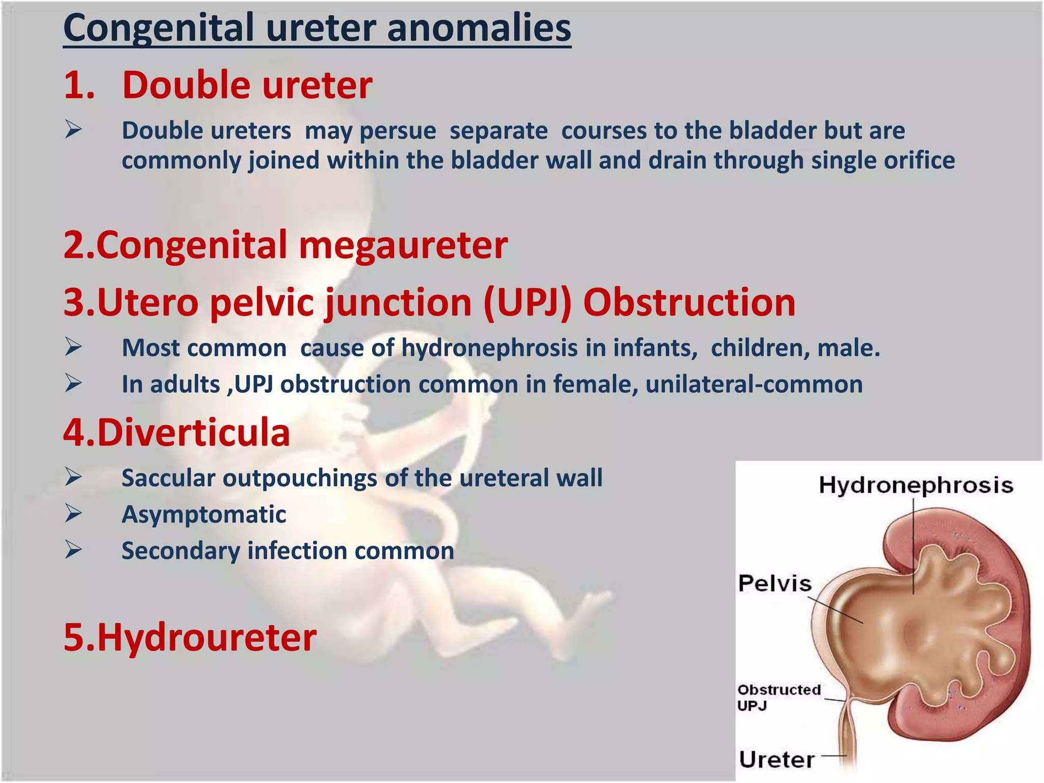 Developmental anomalies of Renal system | PPTX