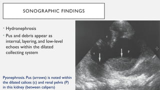 Normal anatomy of the urinary system and their ultrasound findings as ...