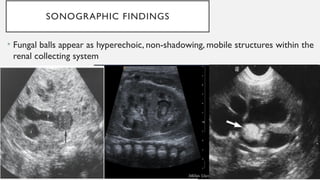Normal anatomy of the urinary system and their ultrasound findings as ...