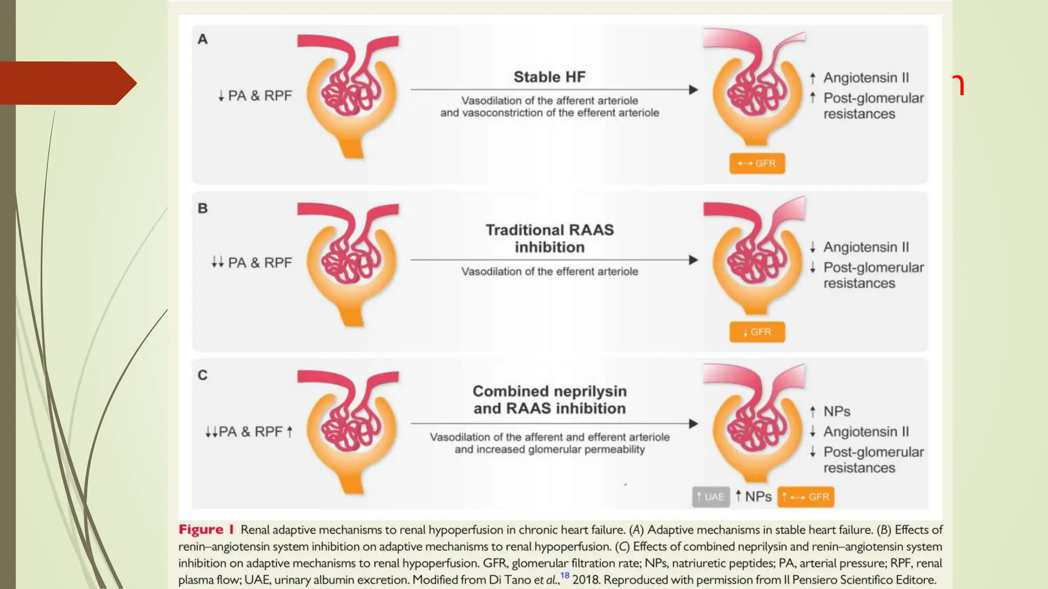 Renal protection in chronic heart failure.pptx