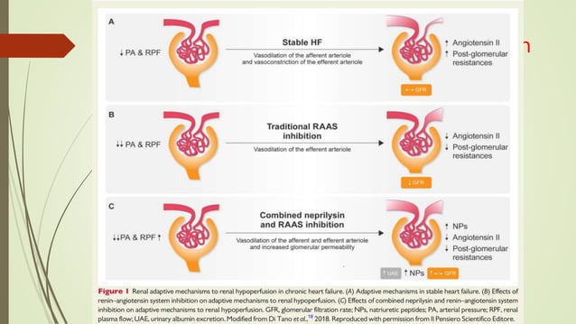 Renal protection in chronic heart failure.pptx