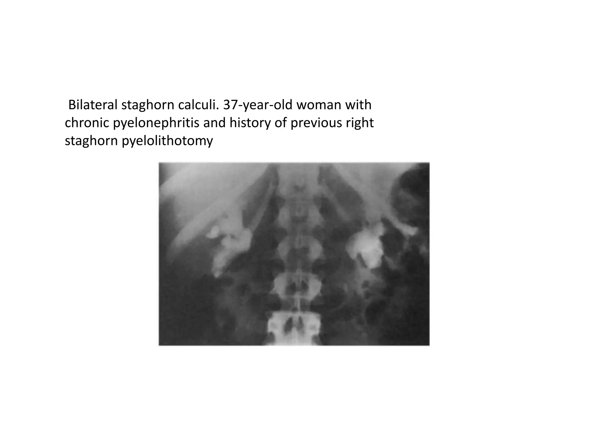 Renal radilogy | PPTX
