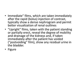 Renal radilogy | PPTX
